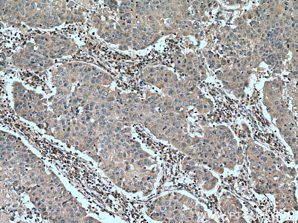 MMP9 (N-terminal) antibody (10375-2-AP) | Proteintech