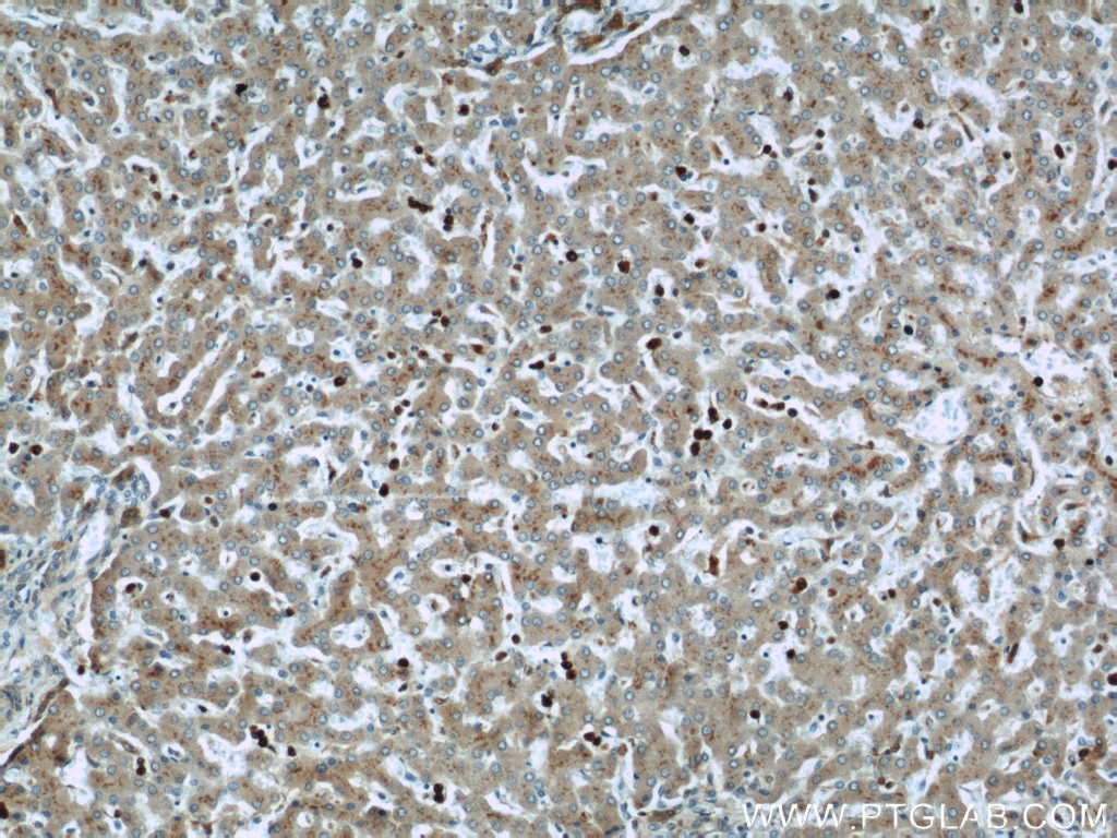 MPO antibody (22225-1-AP) | Proteintech