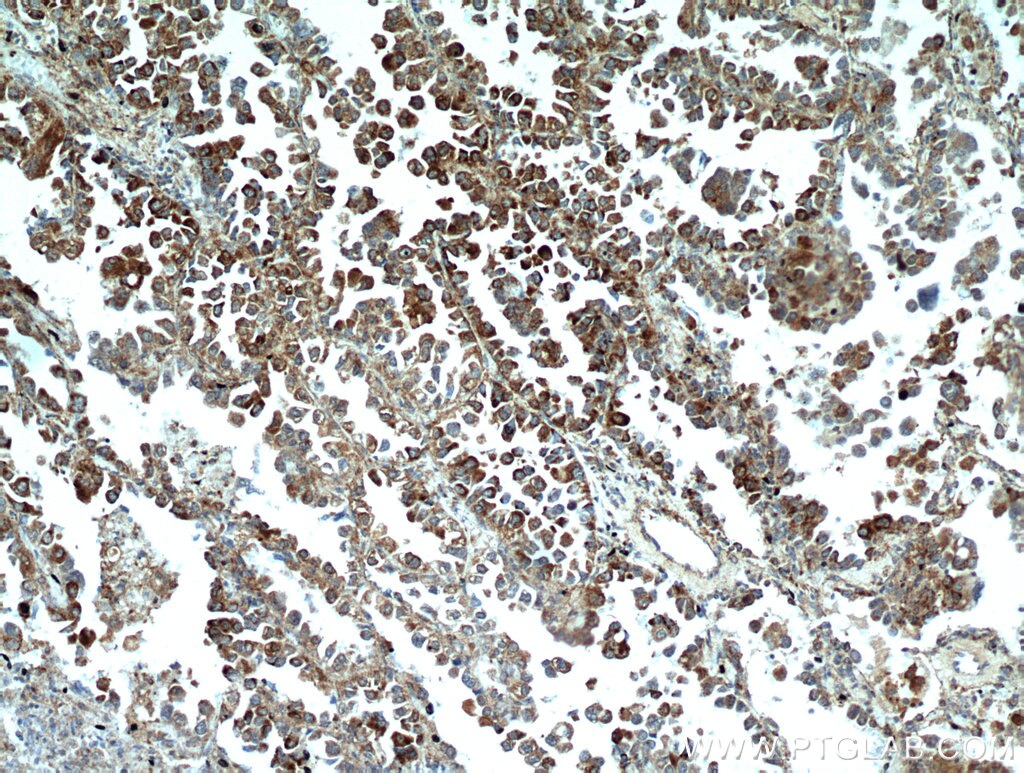 MPP3 antibody (14650-1-AP) | Proteintech