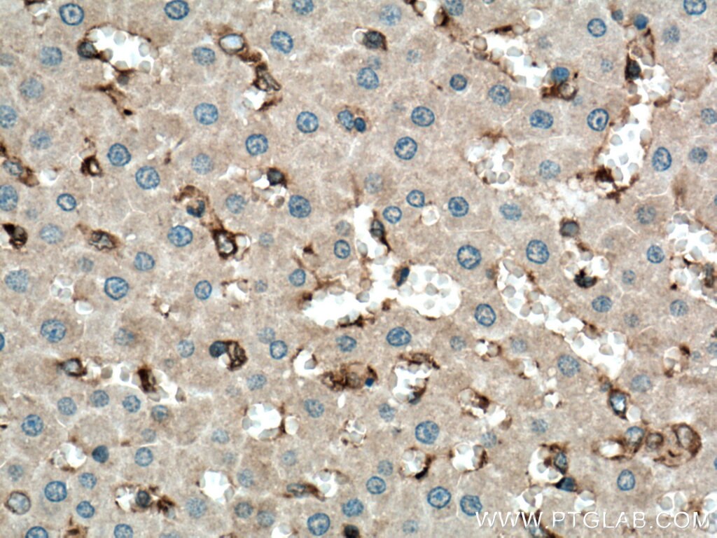 CD206 Antibody 18704-1-AP | Proteintech