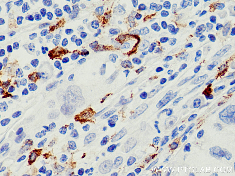 CD206 Antibody 60143-1-Ig | Proteintech
