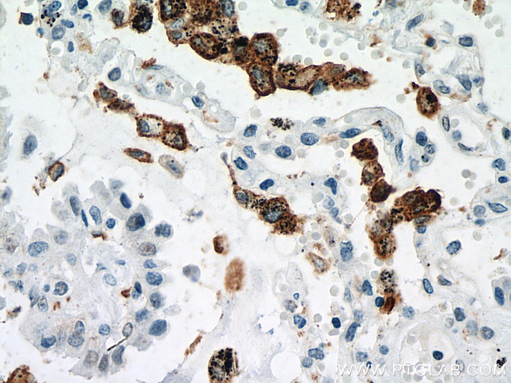 CD206 Antibody 60143-1-Ig | Proteintech