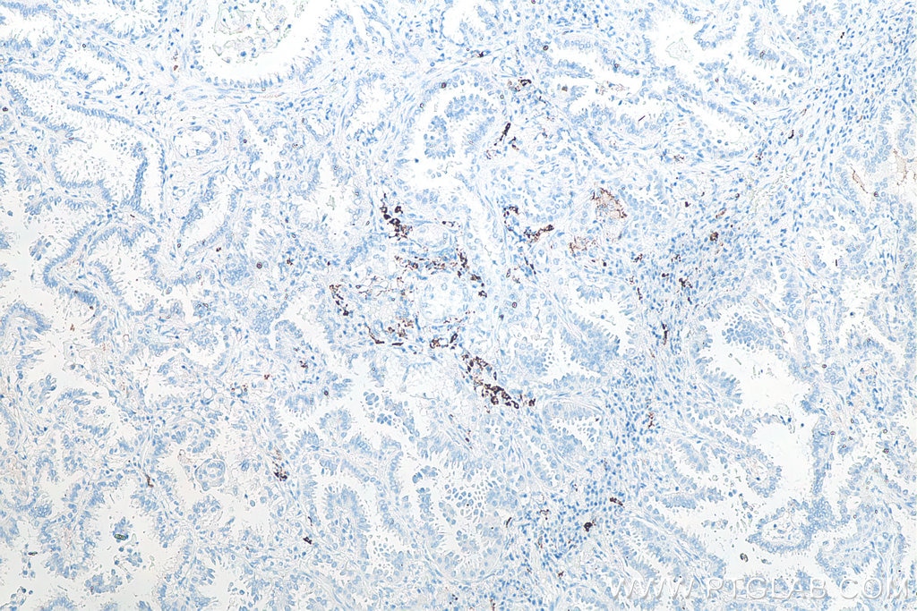 CD206 antibody (60143-1-Ig) | Proteintech