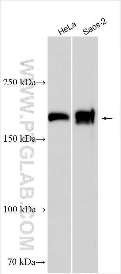 MRC2 antibody (21410-1-AP) | Proteintech