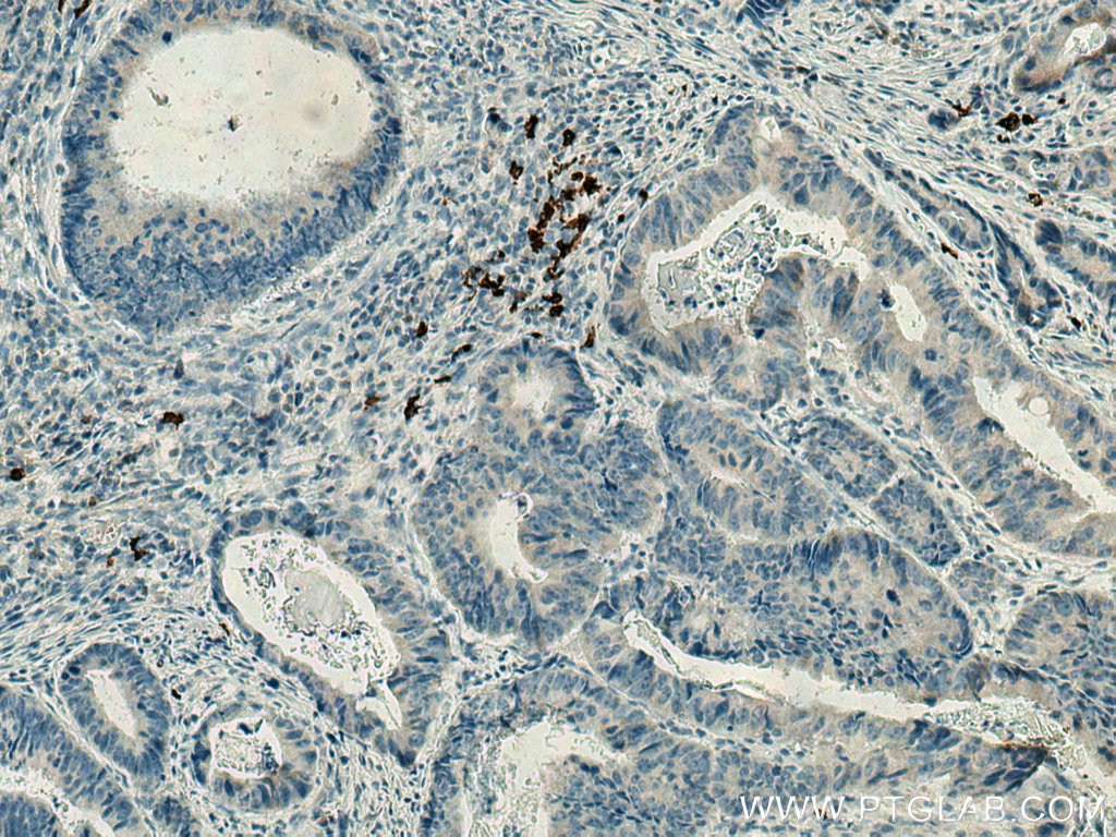 CD20 antibody (24828-1-AP) | Proteintech