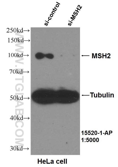MSH2 antibody (15520-1-AP) | Proteintech