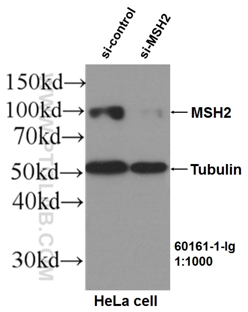 MutS Homolog 2 Antibodies | AntibodyResource.com