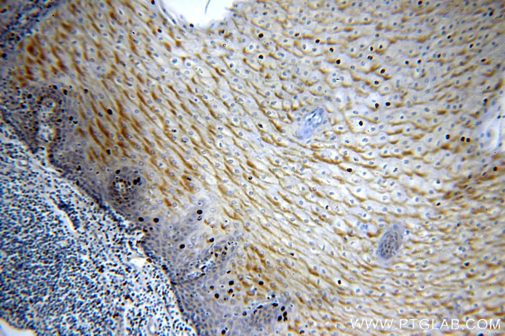 GDF8/Myostatin Antibody 19142-1-AP | Proteintech