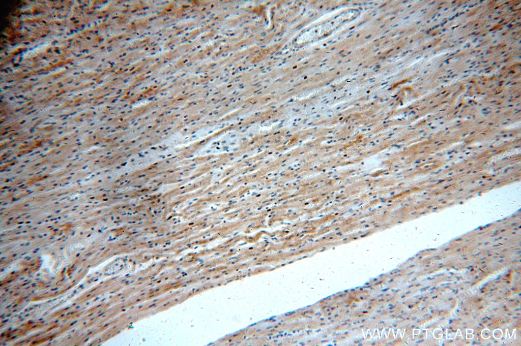 GDF8/Myostatin Antibody 19142-1-AP | Proteintech