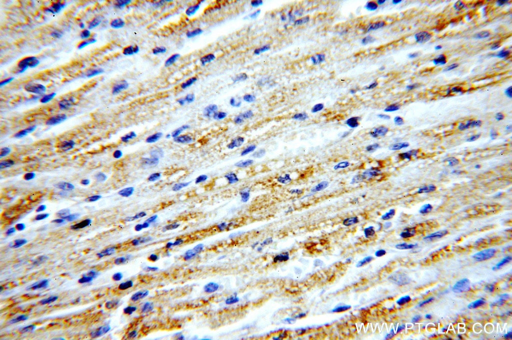 GDF8/Myostatin Antibody 19142-1-AP | Proteintech