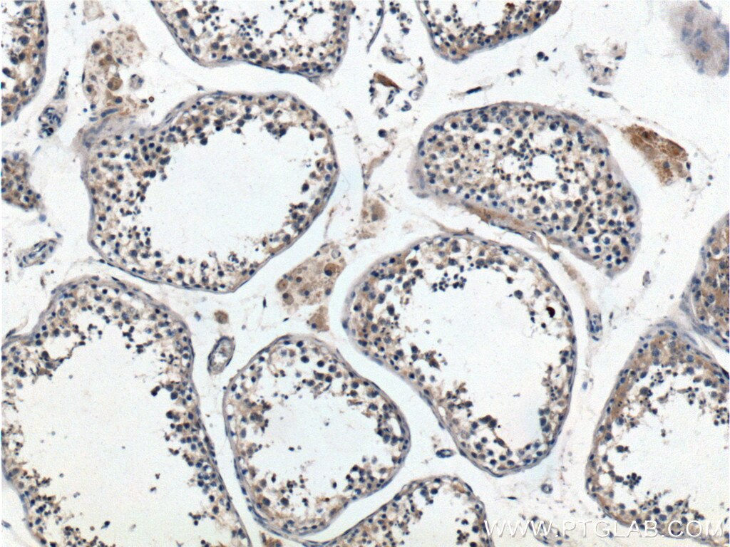mTOR Antibody 20657-1-AP | Proteintech
