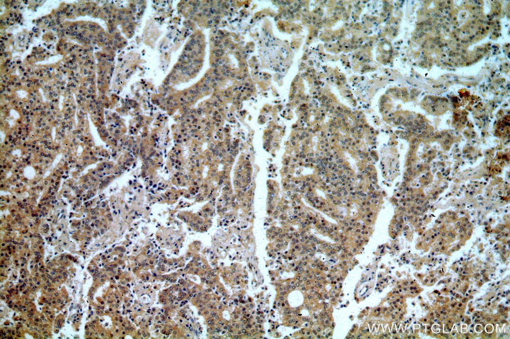 MTOR Antibody 20657-1-AP | Proteintech