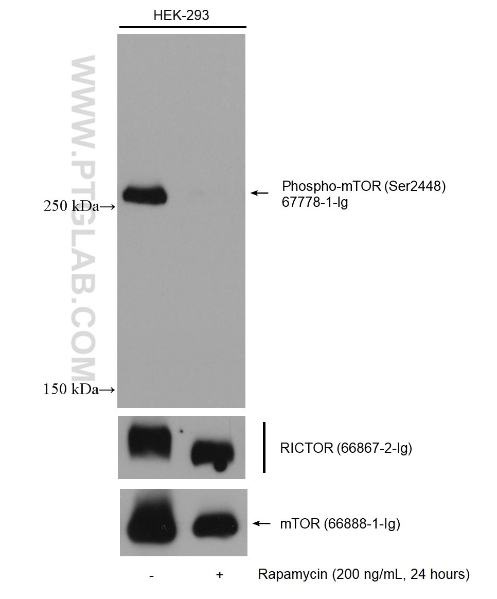 mTOR antibody (66888-1-Ig) | Proteintech