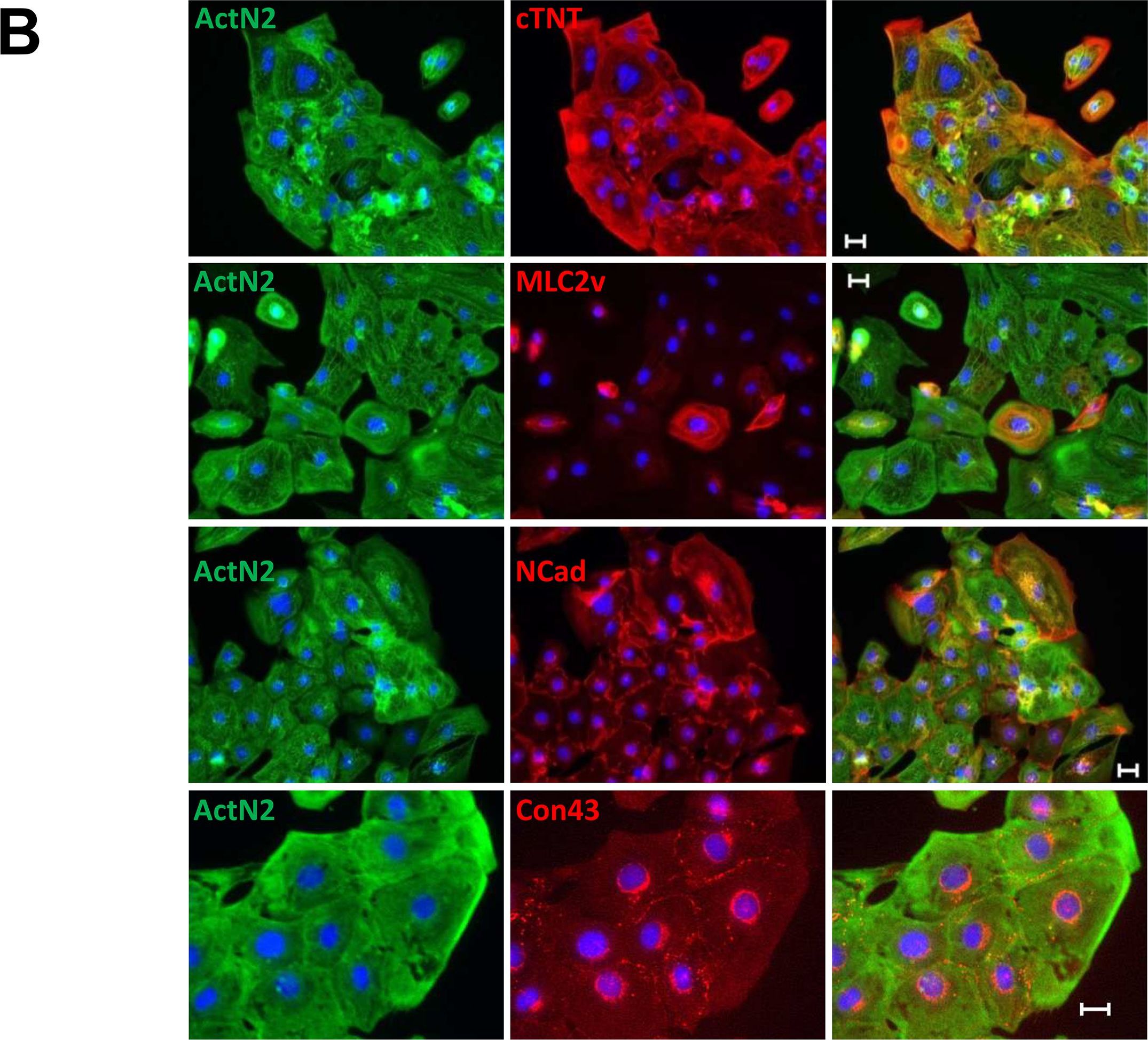 Myosin Light Chain 2/MLC-2V Antibody 10906-1-AP | Proteintech
