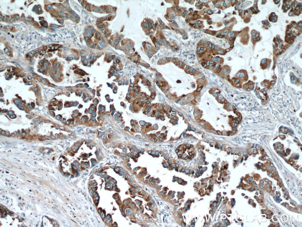 Napsin A Antibody 60259-1-Ig | Proteintech