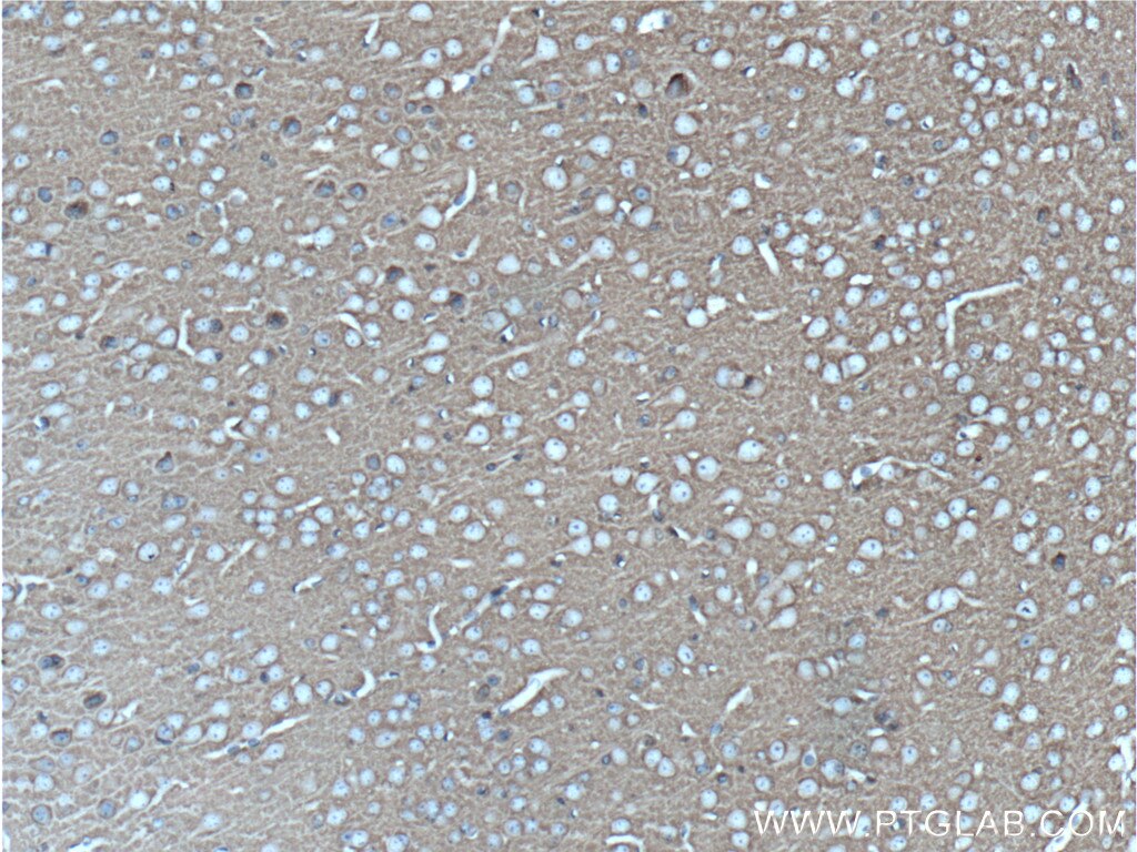 NCAM1/CD56 Antibody 14255-1-AP | Proteintech