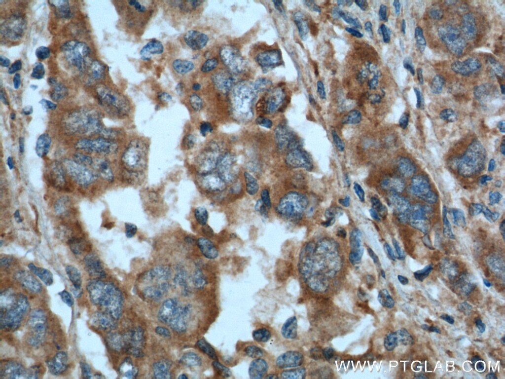 TTF1; NKX2-1 Antibody 21777-1-AP | Proteintech