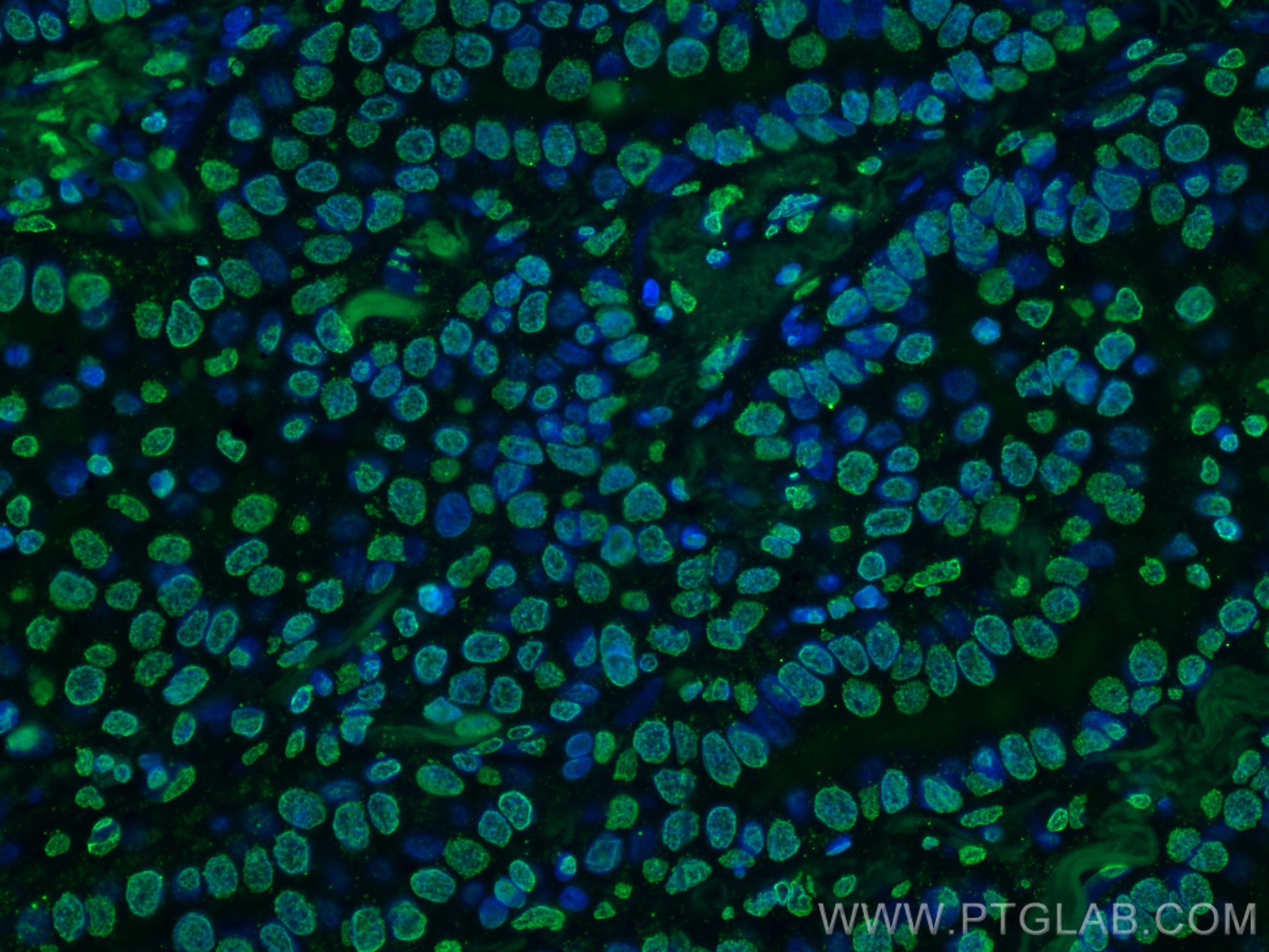TTF1 antibody (66034-1-PBS) | Proteintech