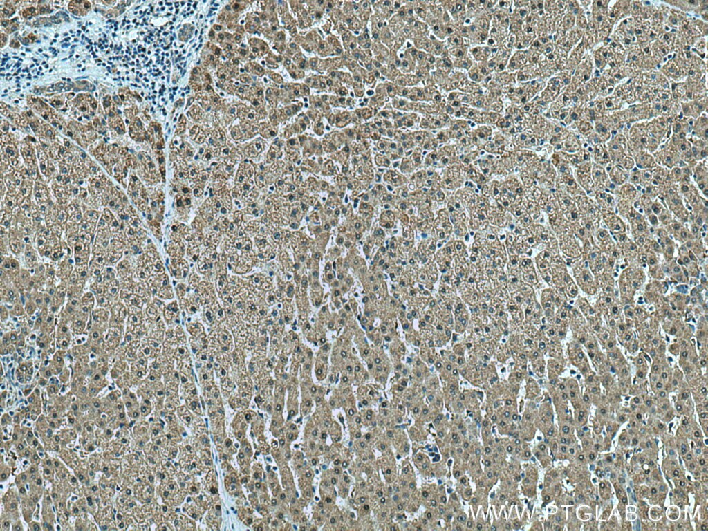 iNOS Antibody (18985-1-AP) | Proteintech