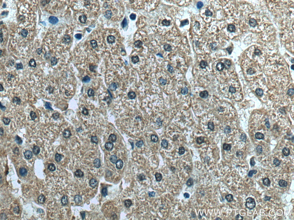 iNOS Antibody (18985-1-AP) | Proteintech