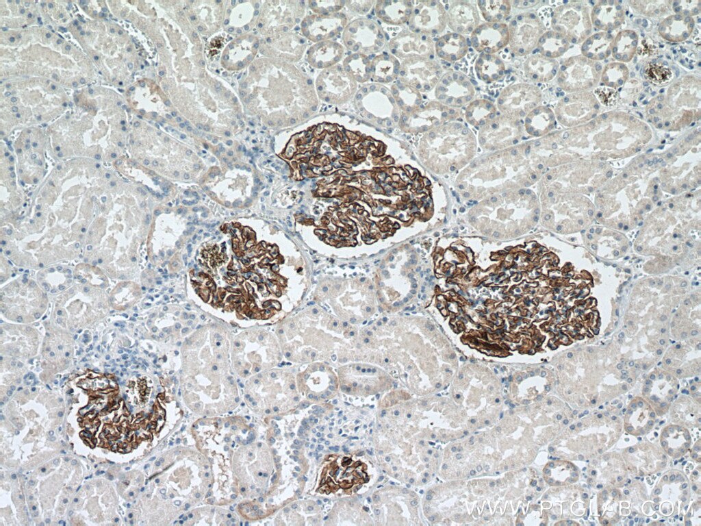Nephrin antibody (66970-1-Ig) | Proteintech