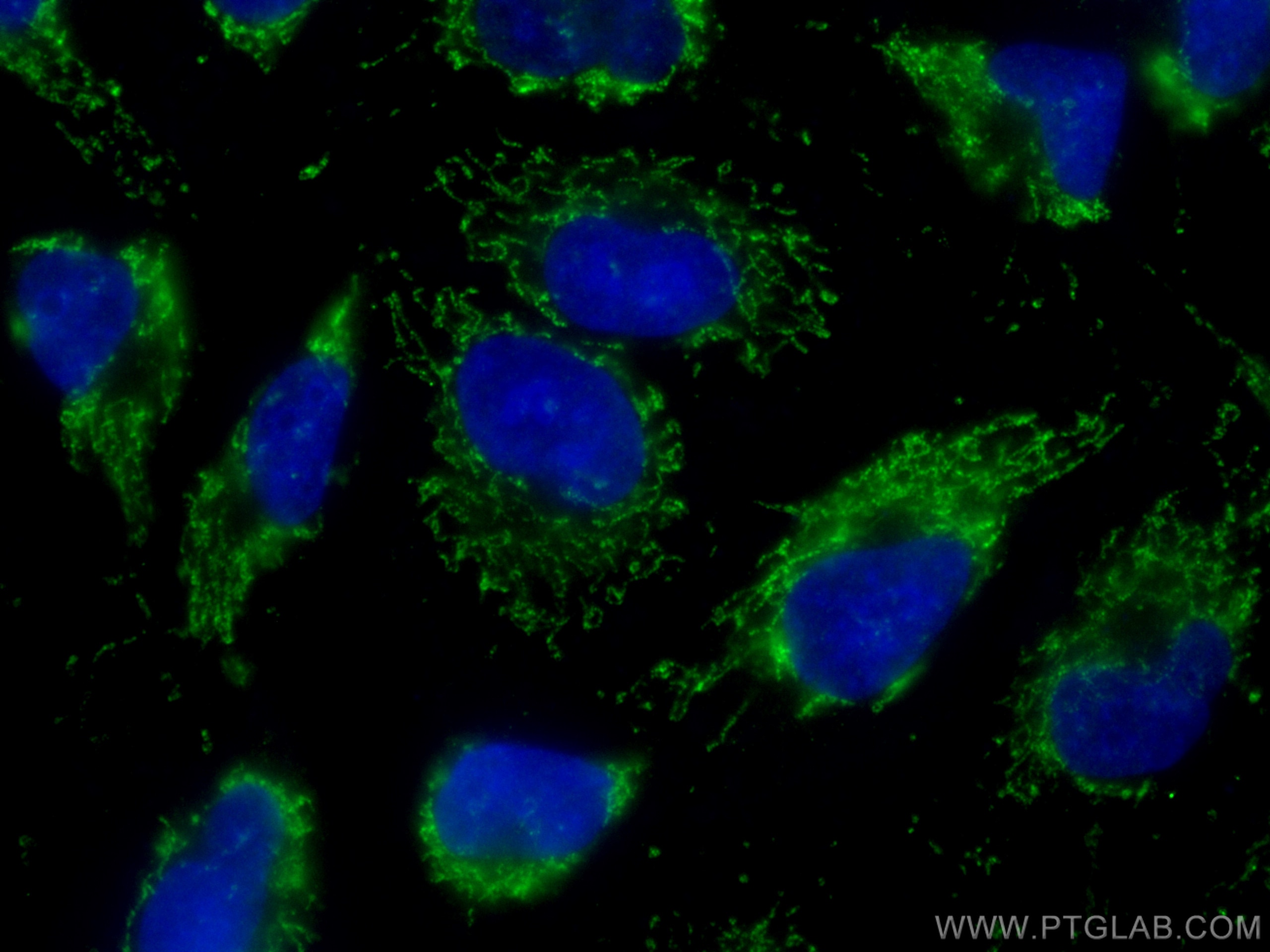Napsin A antibody (CL488-60259) | Proteintech