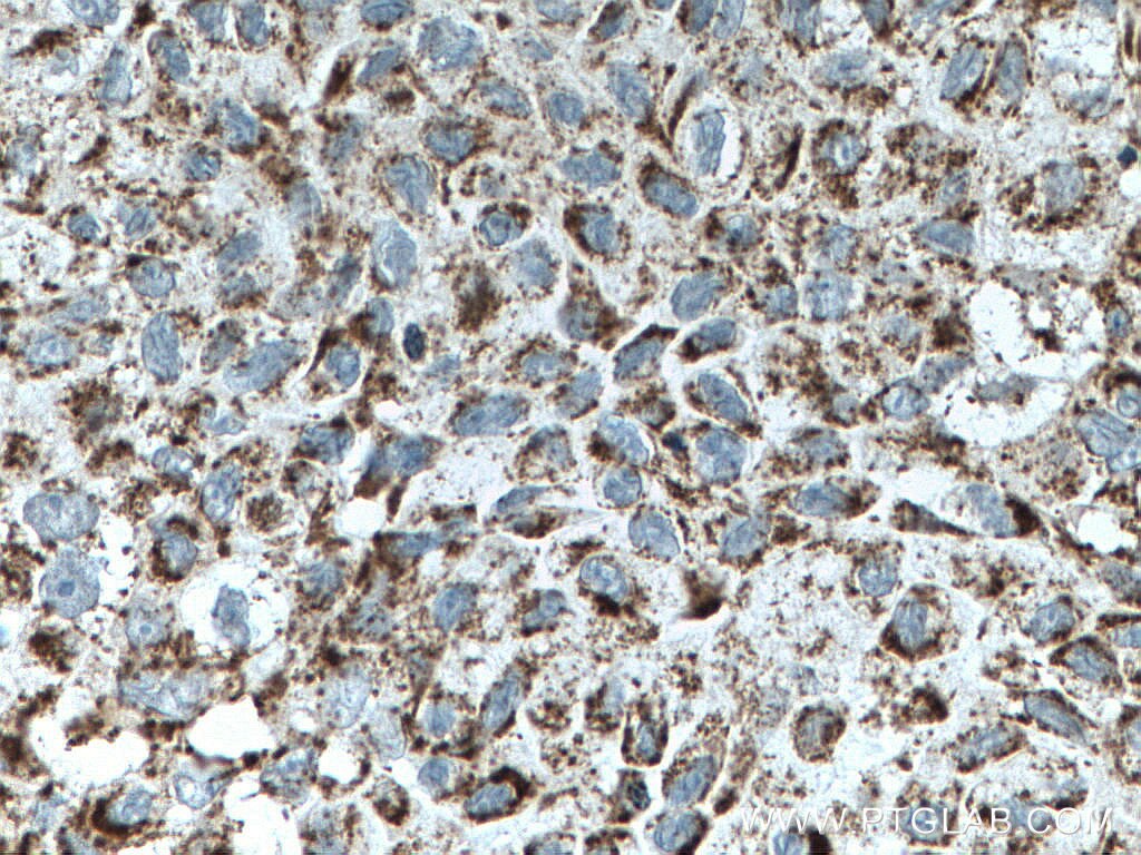 OGDH antibody (15212-1-AP) | Proteintech