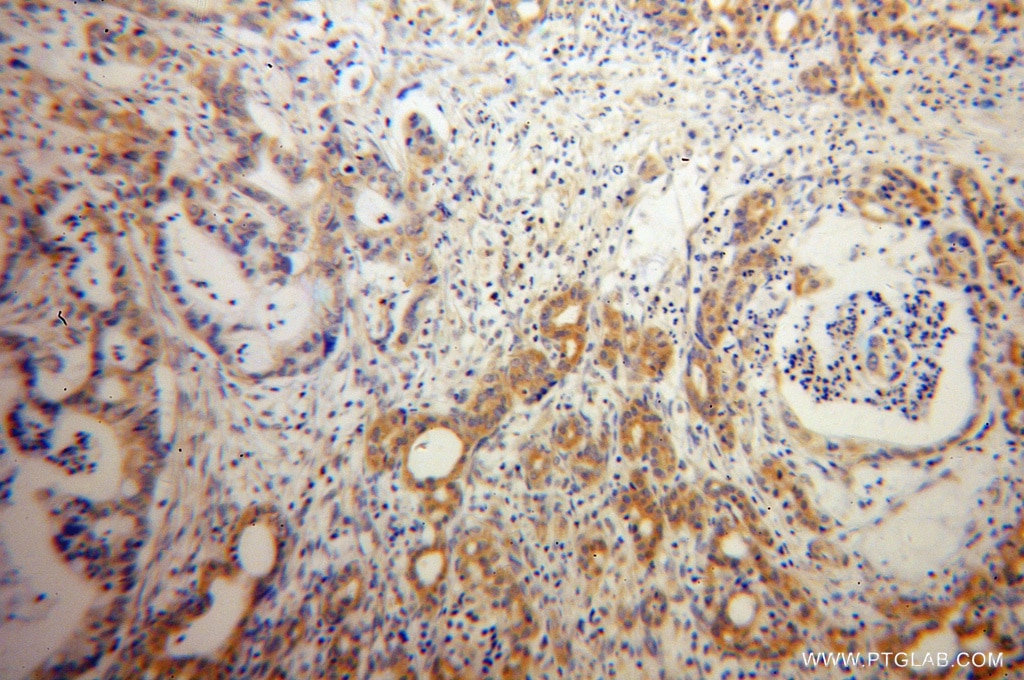 OPTN Antibody 10837-1-AP | Proteintech