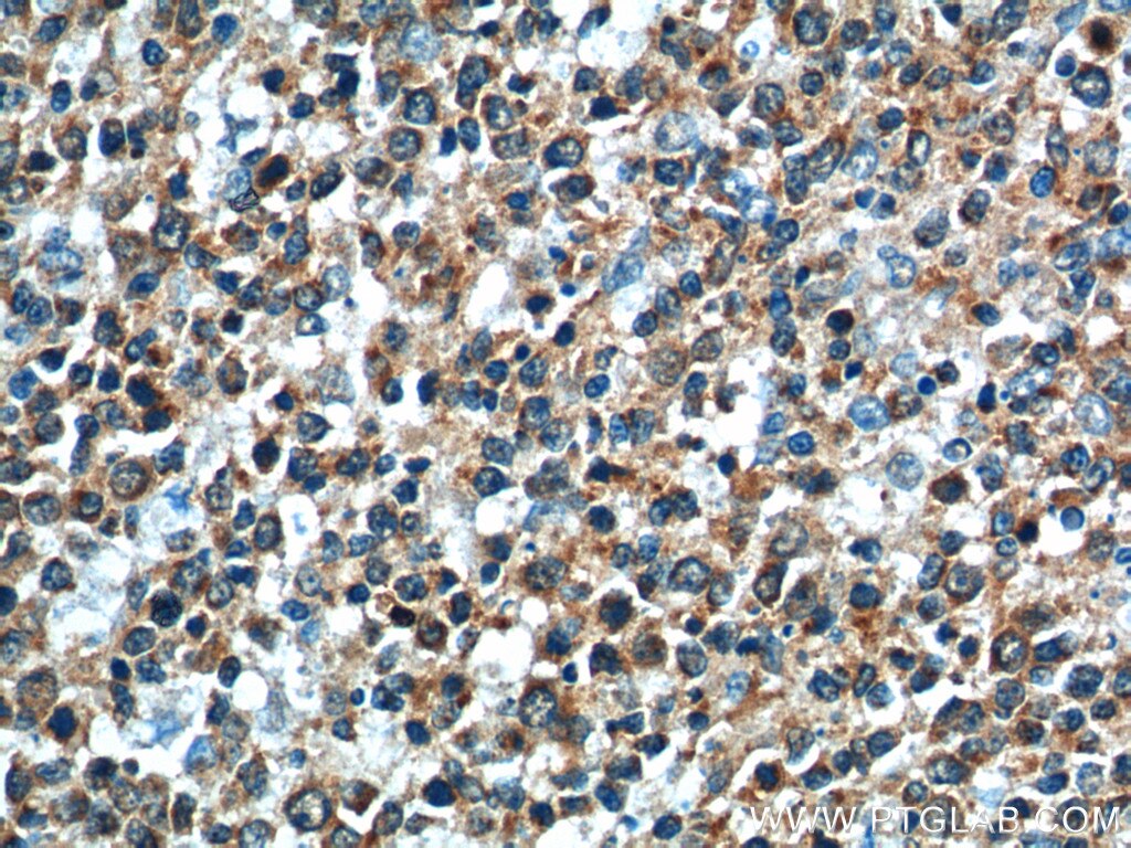 P16-INK4A Antibody 10883-1-AP | Proteintech