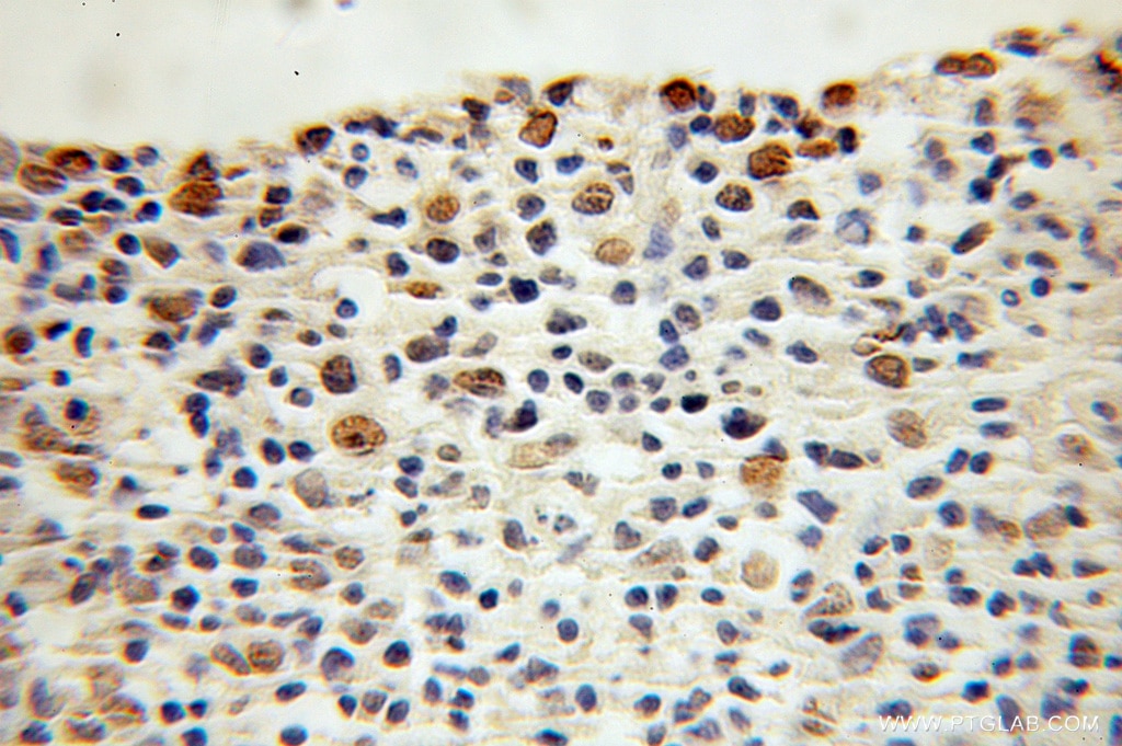 P16-INK4A Antibody (10883-1-AP) | | Proteintech