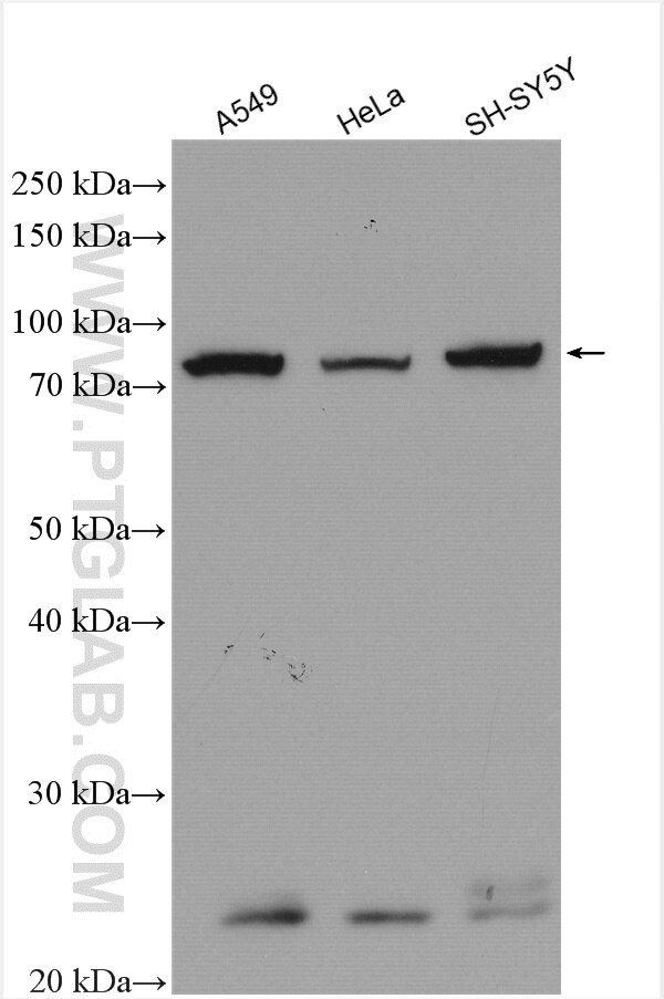 P2RX4 antibody (13534-1-AP) | Proteintech