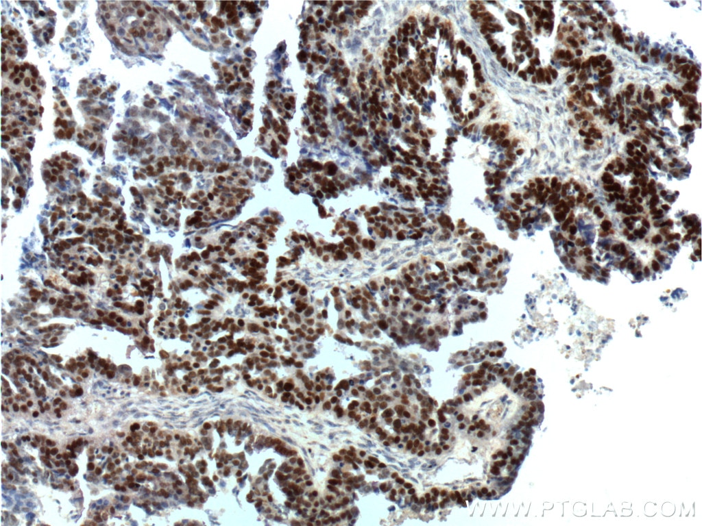 P53 Antibody 10442-1-AP | Proteintech