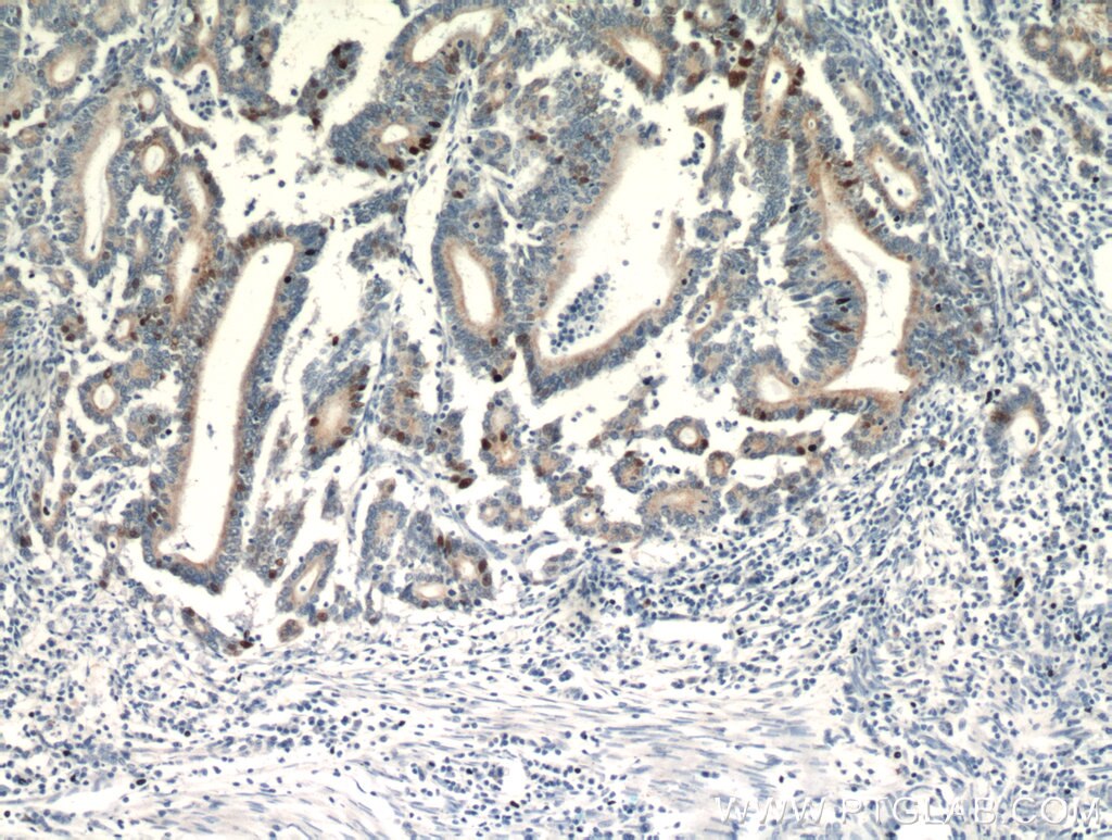 P53 Antibody 10442-1-AP | Proteintech