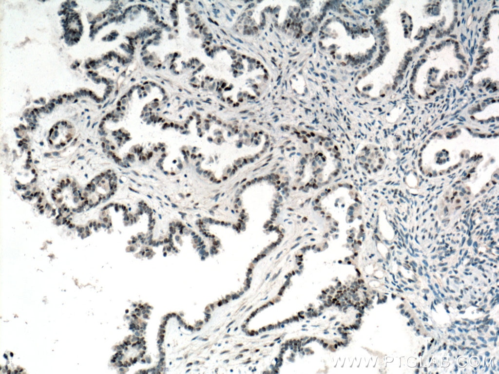 P53 antibody (60283-2-Ig) | Proteintech