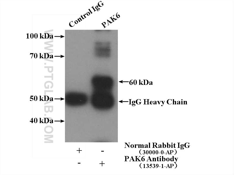 PAK6 Antibody 13539-1-AP | Proteintech