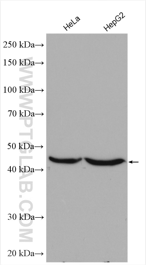 PANK1 antibody (11768-1-AP) | Proteintech