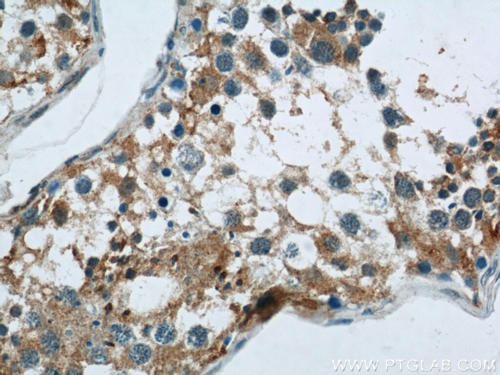 PAOX antibody (18972-1-AP) | Proteintech
