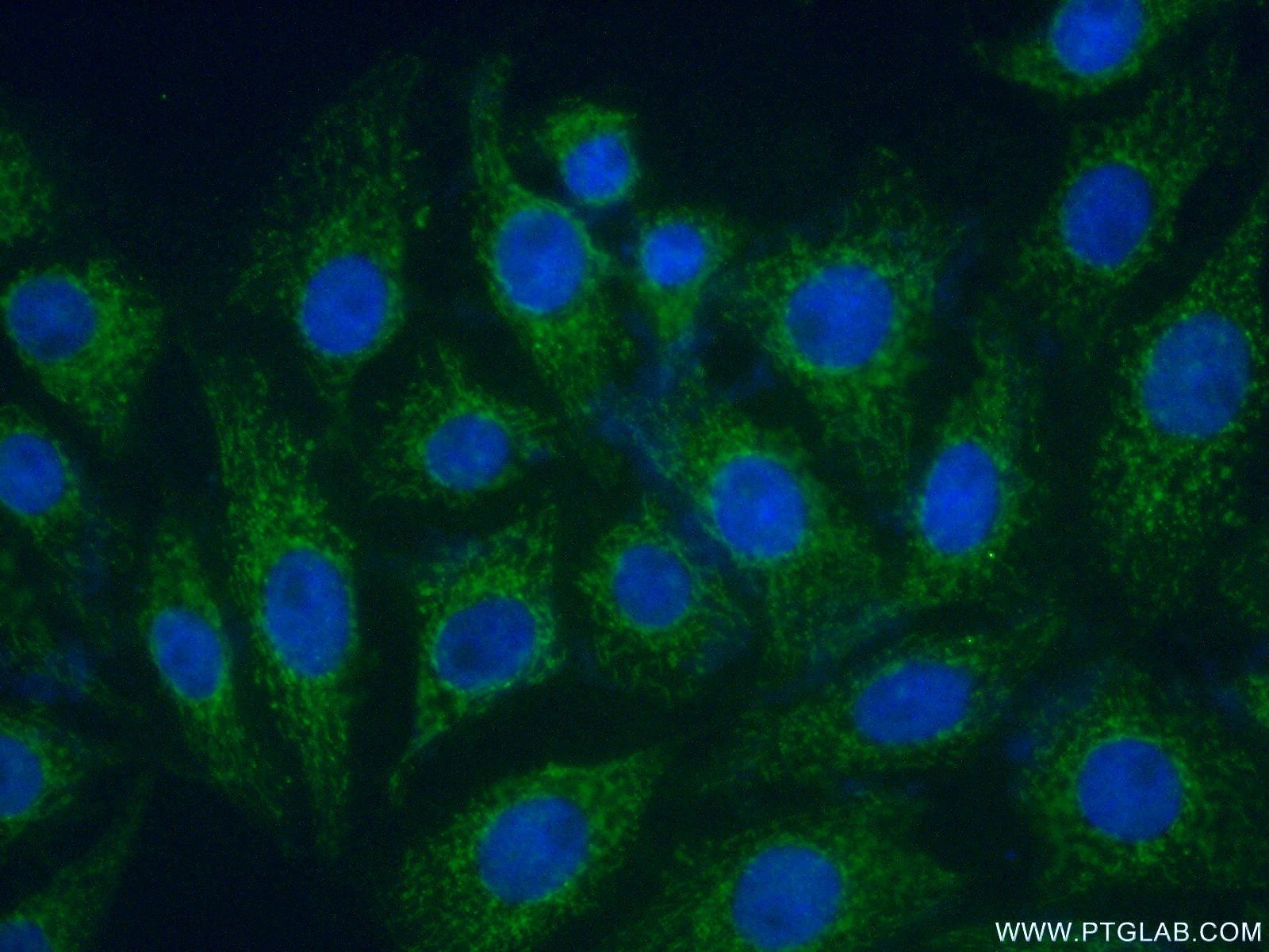 PARK2/Parkin antibody (14060-1-AP) | Proteintech