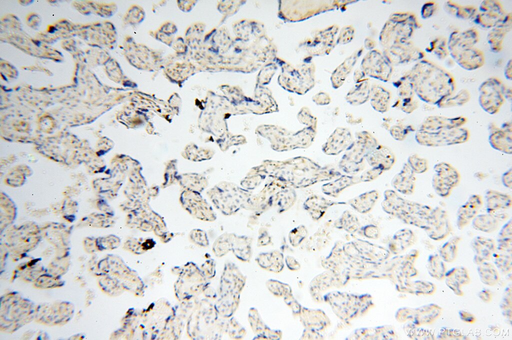 Granulin Antibody 10053-1-AP | Proteintech