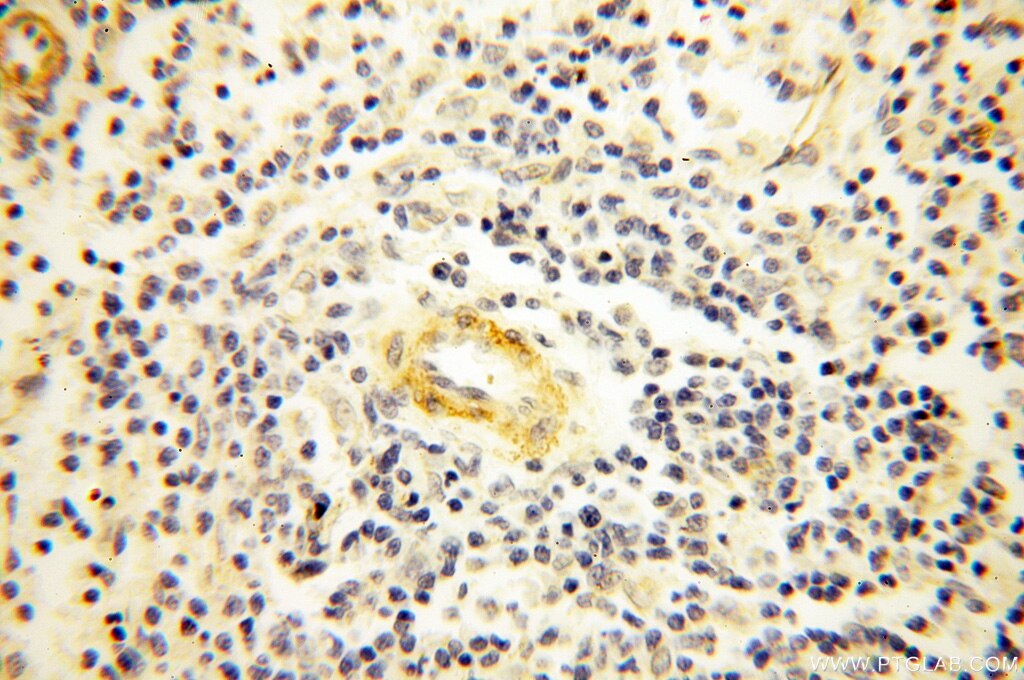 Granulin Antibody 10053-1-AP | Proteintech