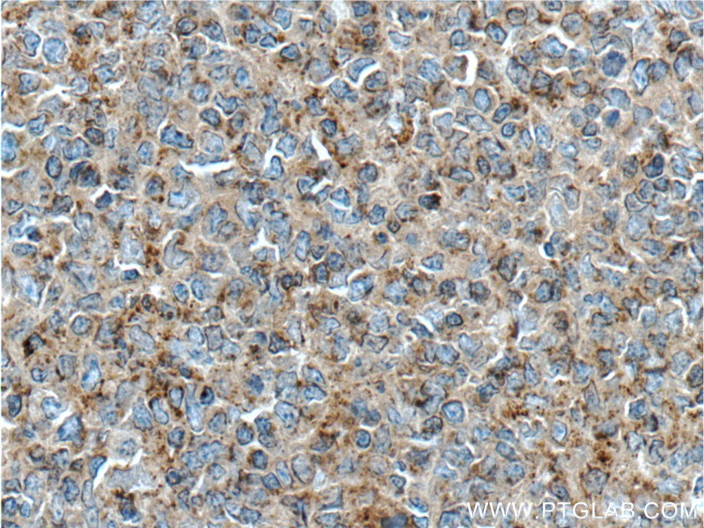 PD-L1/CD274 Antibody 66248-1-Ig | Proteintech