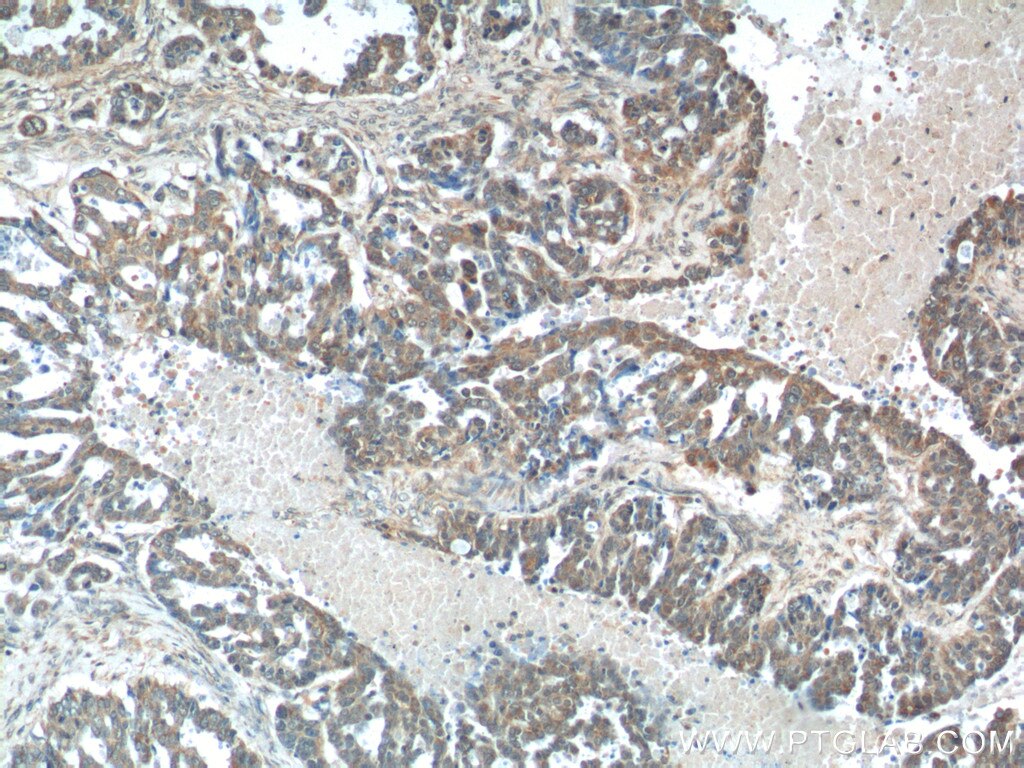 PD-1/CD279 Antibody 18106-1-AP | Proteintech