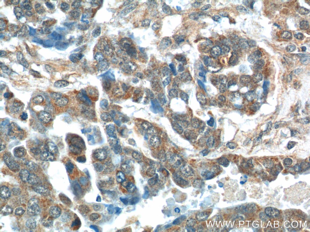 PD-1/CD279 Antibody 18106-1-AP | Proteintech