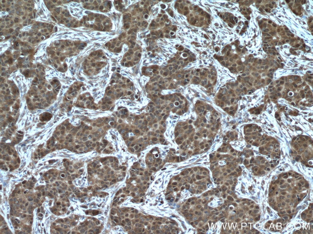 PDCD5 Antibody 12456-1-AP | Proteintech