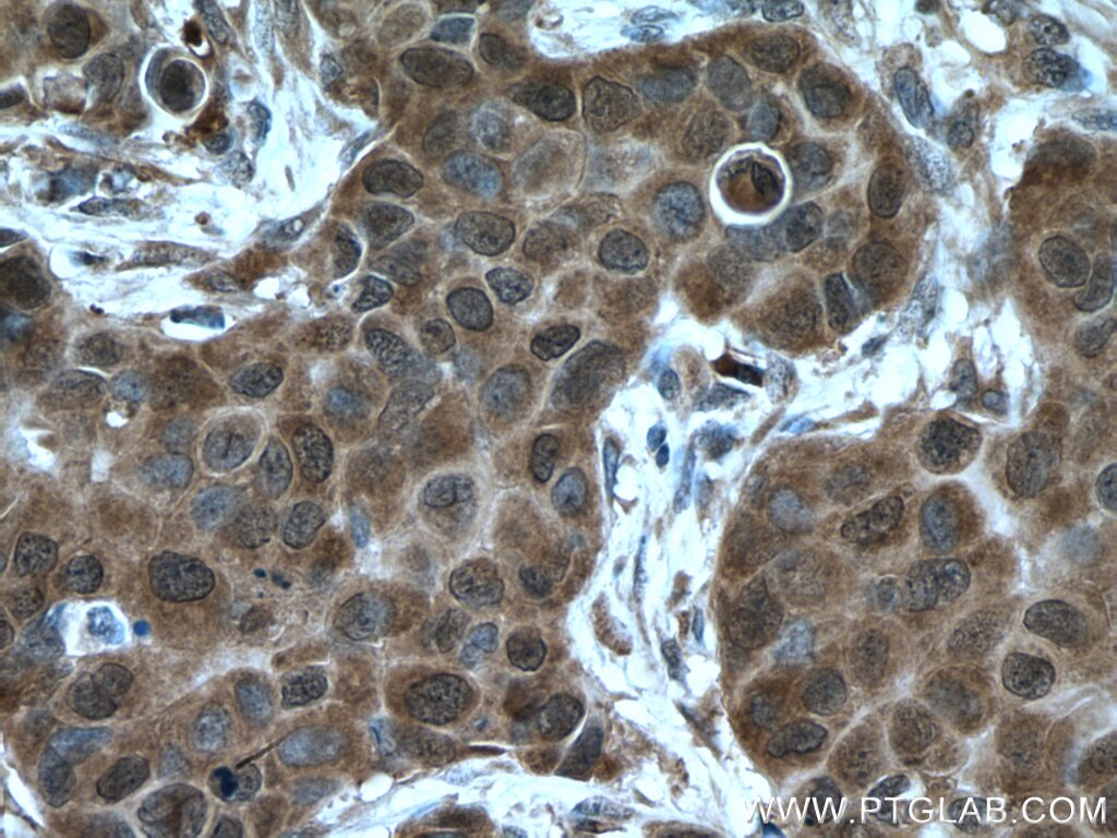 PDCD5 Antibody 12456-1-AP | Proteintech