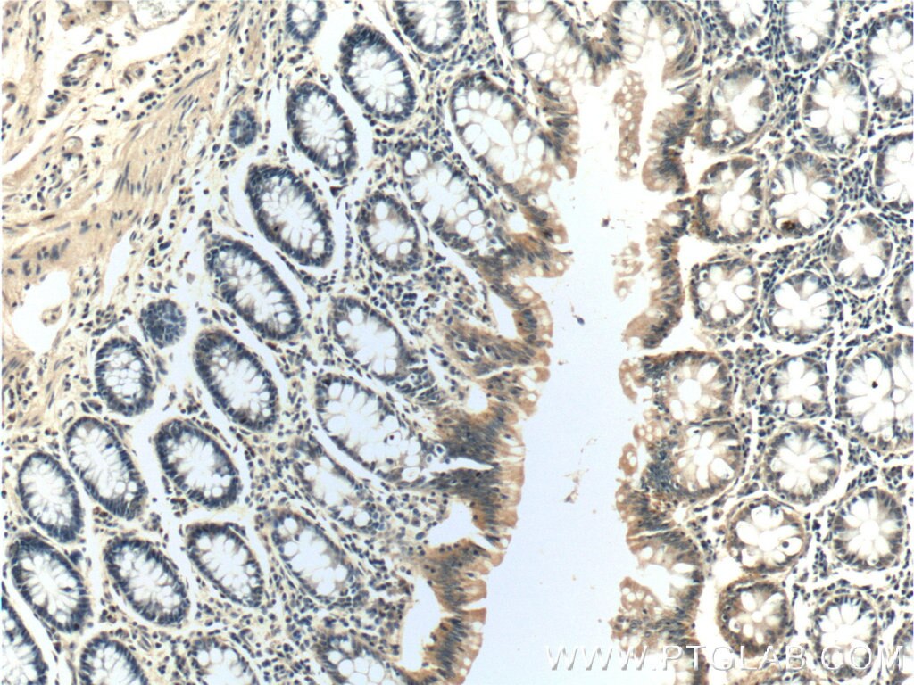 PDCD5 Antibody 12456-1-AP | Proteintech