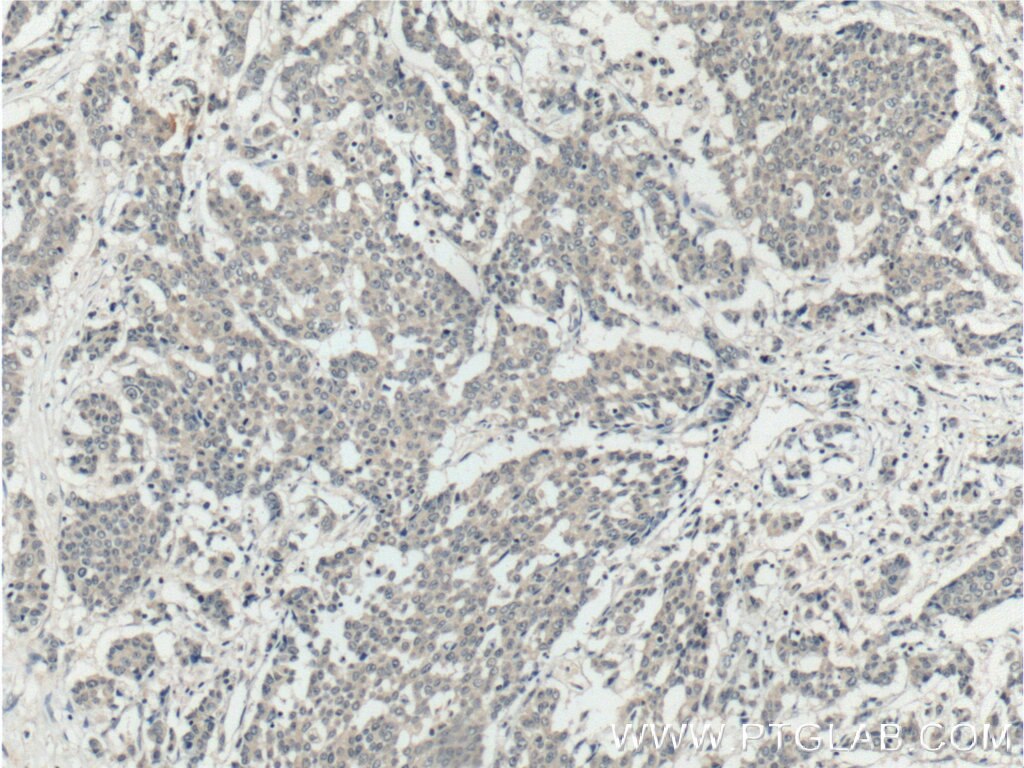 PDCD5 Antibody 12456-1-AP | Proteintech