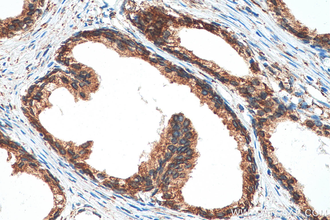 PDI antibody (80170-1-RR) | Proteintech