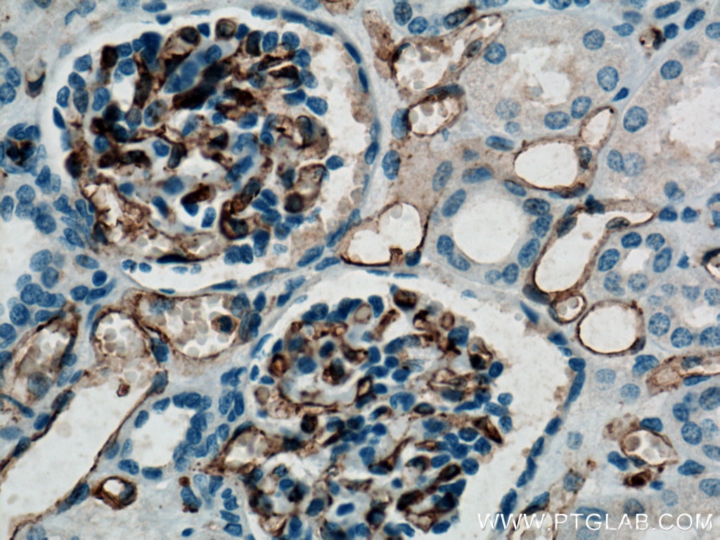CD31 antibody (11265-1-AP) | Proteintech