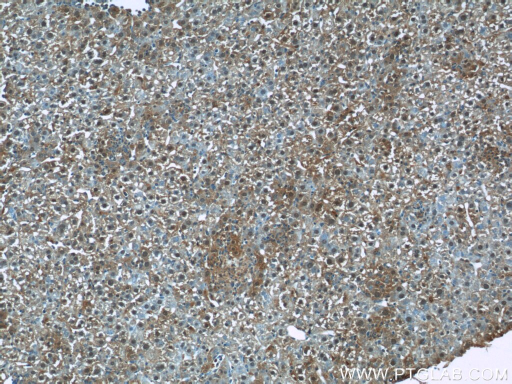 PEG10 Antibody 14412-1-AP | Proteintech